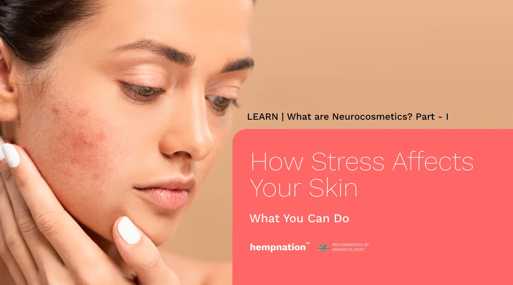 How Stress Affects Your Skin (And What You Can Do) – Hempnation